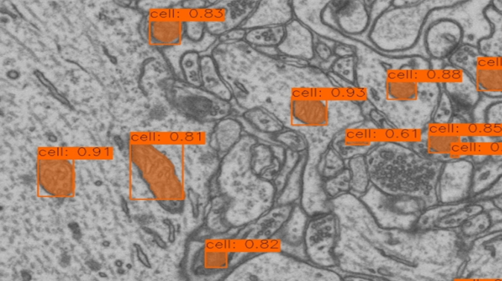 Analyzing Electron Microscopy with YOLO 11 in LabVIEW: A Promising Advancement in Automated ...